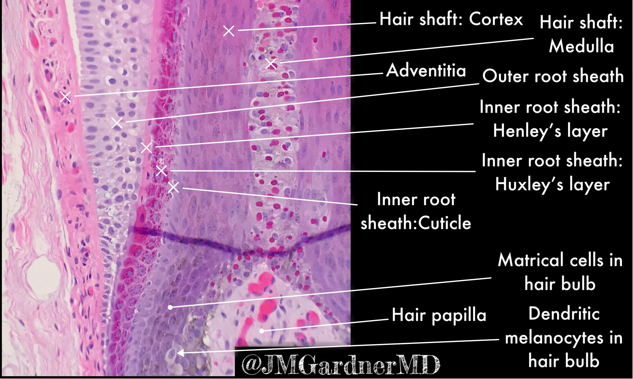 Hair Follicle Root With Inner And Outer Root Sheath Labeled KiKo XP Hair Follicle Root With Inner And Outer Root Sheath Labeled KiKo XP